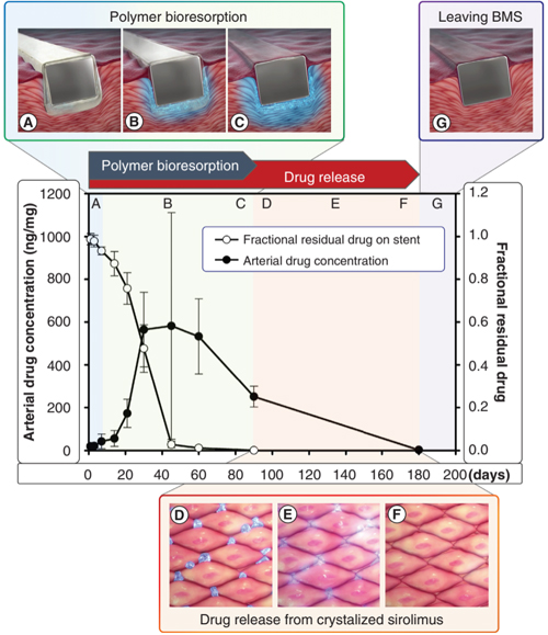 The Clinical Research of Mistent® Coronary Drug Eluting Stent System ...