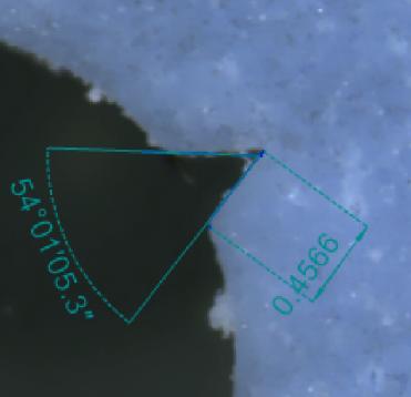 Seledora® Coronary Scoring Balloon Catheter– Product Overview - Kossel ...